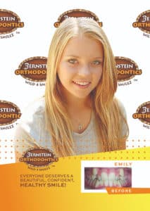 Getting Started | New Patients at Bernstein Orthodontics